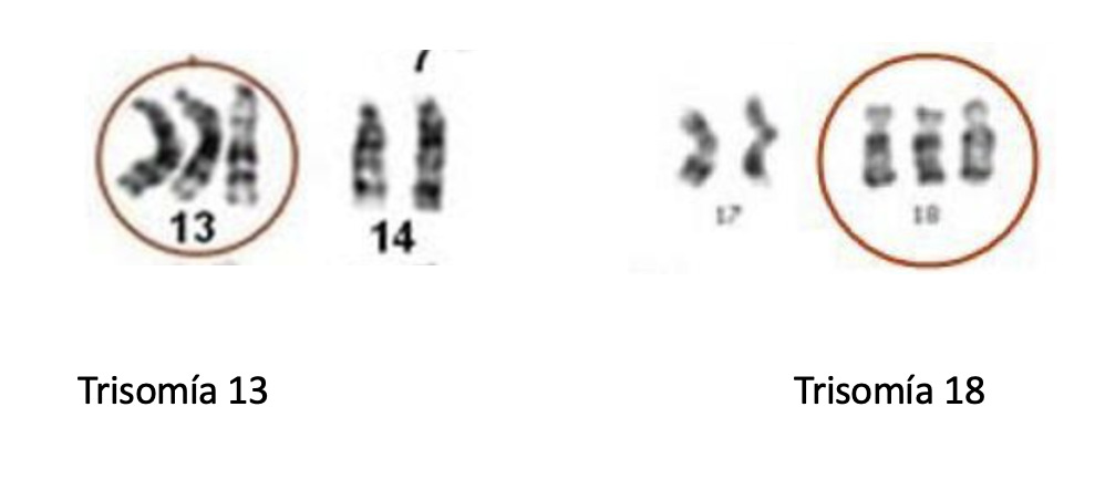 ANOMALIAS CROMOSÓMICAS EN EL FETO - Salud Materno Infantil Sagunto